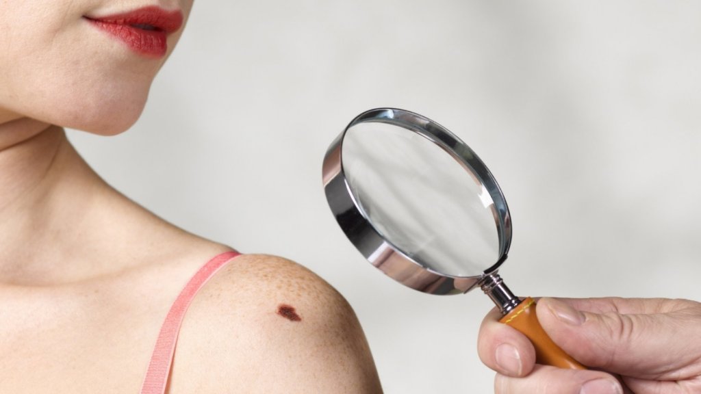 This Incredible AI Is Diagnosing Skin Cancer Just as Well as Trained ...